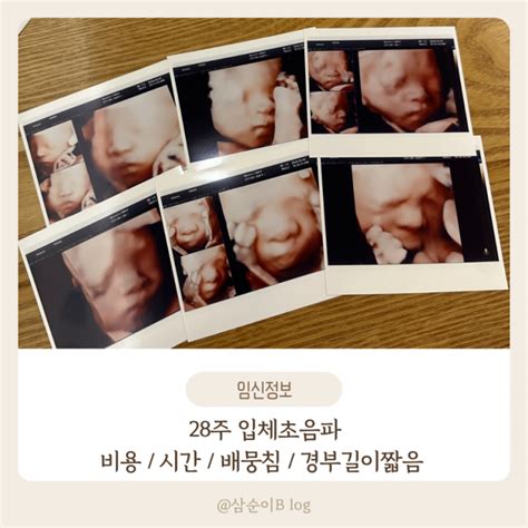 임신 28주 입체초음파 얼굴 눈 코 시기 비용 정보 네이버 블로그