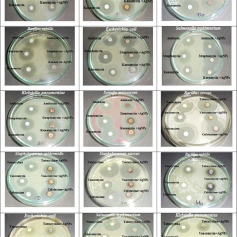 Plates Showing The Increase In Diameter Of Inhibition Zone Of