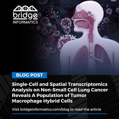 Bridge Informatics On Linkedin Cancer Nsclc Bioinformatics
