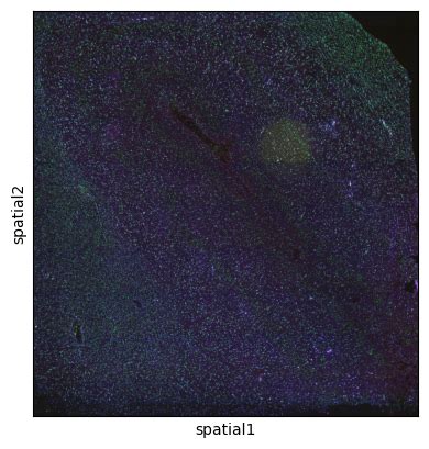 Visium Brain MENDER Documentation