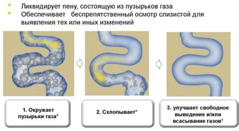 Саб Симплекс. Инструкция для новорожденных, чем лучше Эспумизана ...