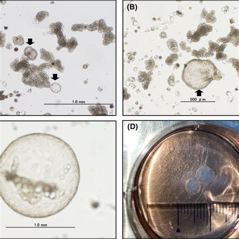 Detection Of Gene Mutations In Endometrial Single Glands Using The