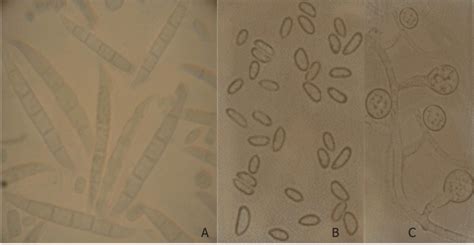 Spores Of Fusarium Sp Nov A Macroconidia B Microconidia And C Download Scientific
