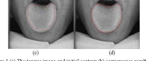 Figure 1 From Tongue Image Segmentation Based On An Improved Geometric