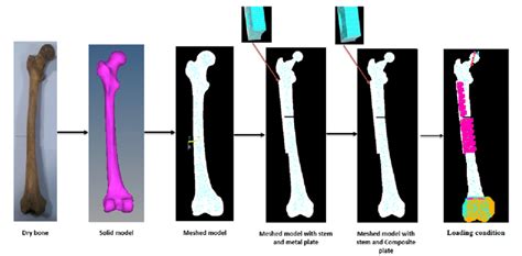 Stages Of Development Of The Finite Element Model Of Femur With Download Scientific Diagram