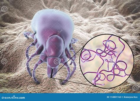 Borrelia Cartoons Illustrations And Vector Stock Images 174 Pictures