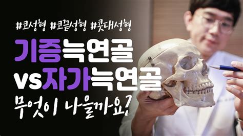 기증늑연골 Vs 자가늑연골 무엇이 나을까요 스페셜코성형센터에서 알려드립니다 Youtube