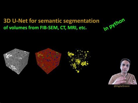 3d U Net In Pytorch Reasontown