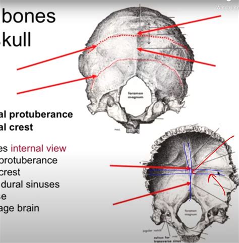 Squamous Portion Of The Occipital Bone Diagram Quizlet