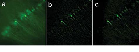 Figure 2 From Optically Sectioned In Vivo Imaging With Speckle Illumination Hilo Microscopy