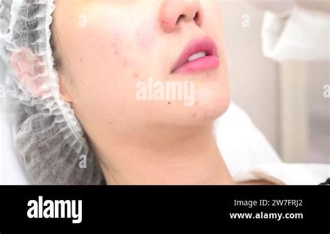 Asian Woman Getting Cosmetic Injection Of Botox In Her Cheeks Botox Injection Performed At