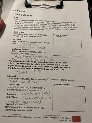 Rad Imaging Tib Fib Knee Flashcards Quizlet