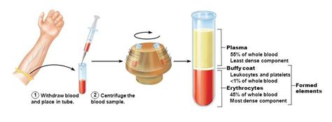Plasma Rich Platelet Injection In Ed Treatment 2024 Istcurologyen