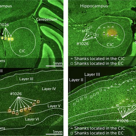 An Example Of Cic Recording Electrode Frequency Spread And Intensity