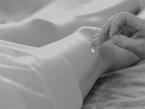 Guide To Understanding And Treating Spider Veins Suncryo