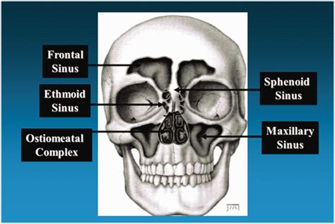 Frontal Sinus Headache