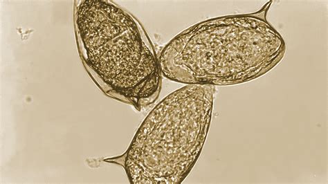 Schistosomiasis Cdc