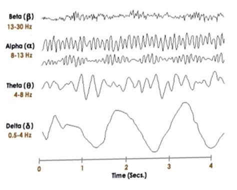 Shows The Typical Normal Brain Rhythms With Their Usual Amplitude Level Download Scientific