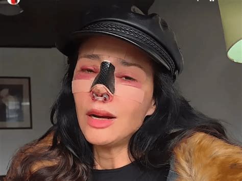 ¿quién Es Dorismar La Modelo Que Enfrenta Graves Secuelas Por Una