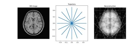 Learn Sampling Pattern — Mri Nufft Documentation