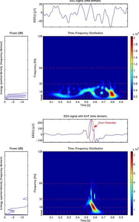 Figure 1 From Eeg Error Potentials Detection And Classification Using Time Frequency Features