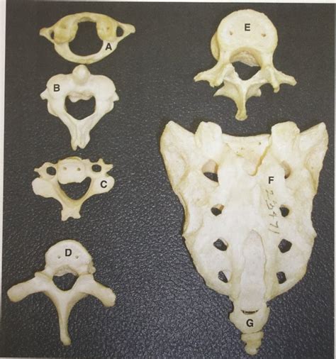 Lab Exercise 8 Vertebra Diagram Quizlet