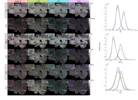 Quantitative Maps Left Example R1 Mtsat And R 2 Maps Obtained With Download Scientific