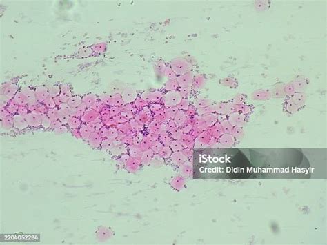 자궁경부 도말 Nilm 교육 조직학을 위한 현미경 보기 인체 조직 0명에 대한 스톡 사진 및 기타 이미지 Istock