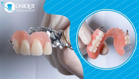 What Are Partial Dentures Unique Dental Lab Blog