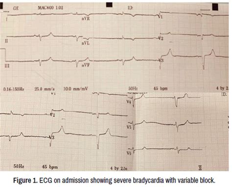 Clinical Case Reports Bradycardia