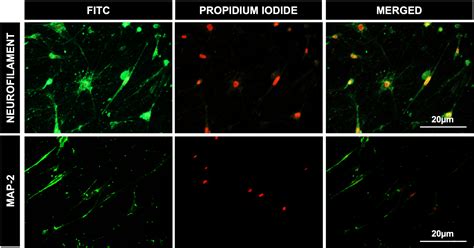 Video Author Spotlight Advancing Tissue Regeneration And Disease Modeling With Dental Pulp