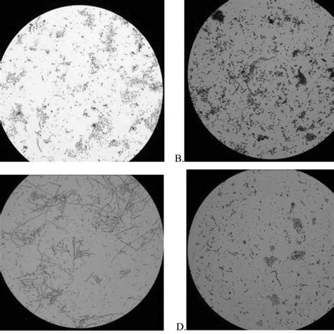 Different Morphotypes Of Bacterial Strains Isolated From The Gastric