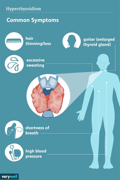 Hyperthyroidism Causes