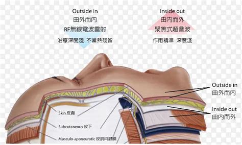 肌肤组织结构图PNG图片素材下载 图片编号8112264 PNG素材网