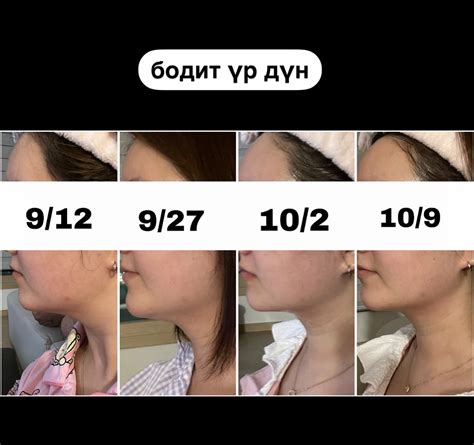 Kmarket Kmarket Added A New Photo