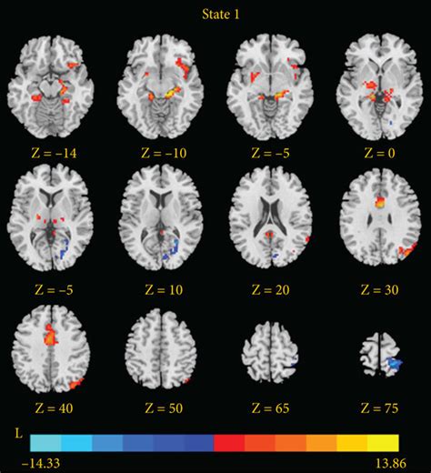 Brain Regions Showing Dynamic Functional Connectivity Differences Based Download Scientific