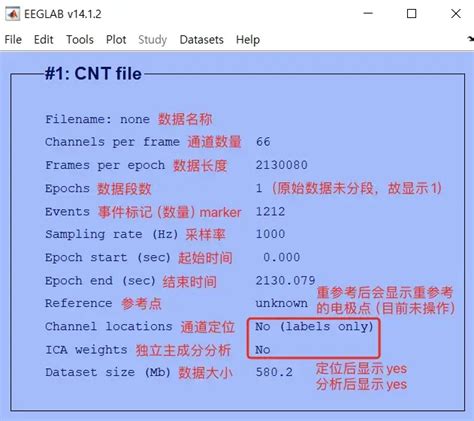 Matlab脑电数据处理精要（三、实操） 知乎
