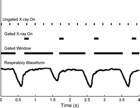 Sample Of The Respiratory Waveform And Gating Window Produced By The