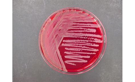 Burkholderia Cepacia Selective Agar And Supplement