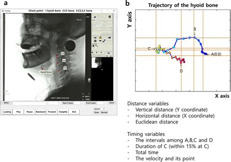This Figure Shows The Automated Kinematic Analysis Program Akap Download Scientific Diagram
