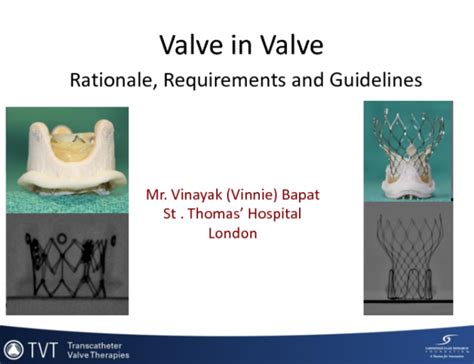 Rationale Technical Requirements And Procedural Considerations