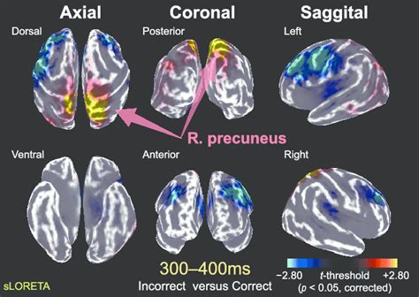 Cortical Sources Of Scalp Potential Effects For Incorrect Temporal Download Scientific Diagram
