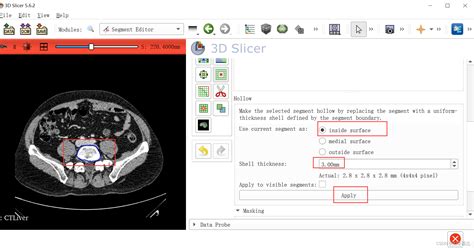3d Slicer的学习（二） 图像的分割3dslicer怎么调整窗宽窗位 Csdn博客