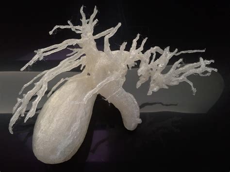 Nevits Blog How To Create A 3d Print From A Medical Scan