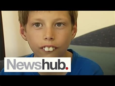 Buck Teeth