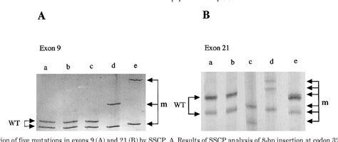 Figure 5 From Mutational Analysis Of Phex Gene In X Linked Hypophosphatemia Semantic Scholar