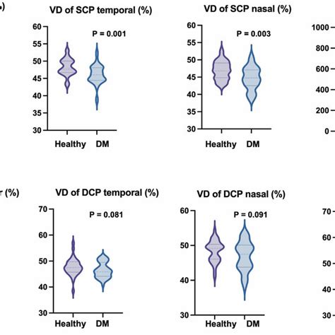 Ocular Biometry In Healthy Volunteers Compared To Patients With