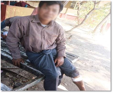 Pdf အမည်ခံအကြမ်းဖက်သမားများထောင်ထားသည့် လက်လုပ်မိုင်းပေါက်ကွဲမှုကြောင့် ၁၁ နှစ်အရွယ်ကလေးငယ် ၁