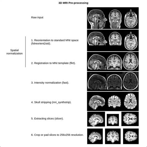 Standard Mri Preprocessing Steps Used In Our Pipeline Tools From The Download Scientific