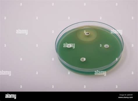Photo Of Growth Of Pseudomonas Bacteria On Nutrient Agar With
